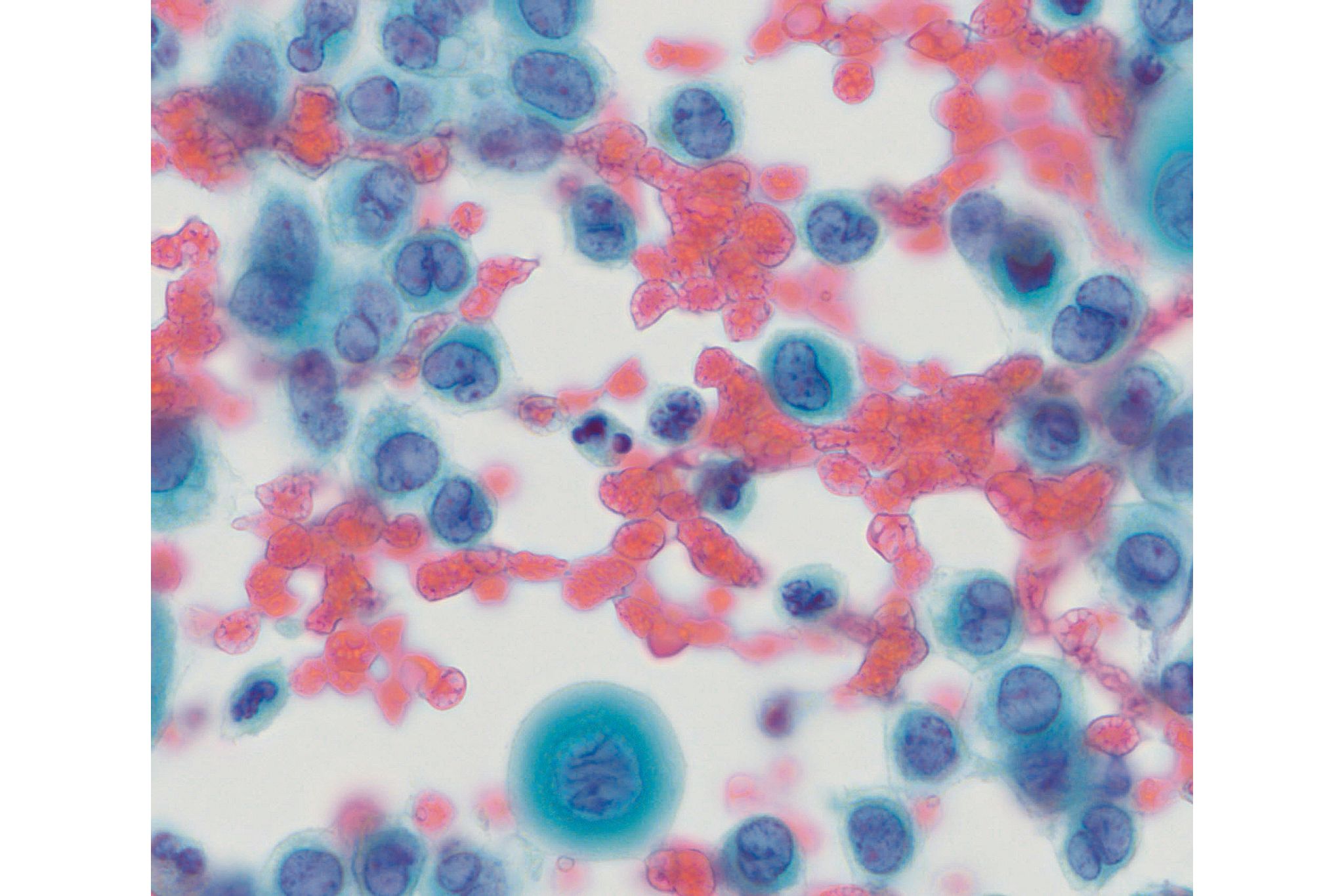 Cytology Clinical Bundle Download