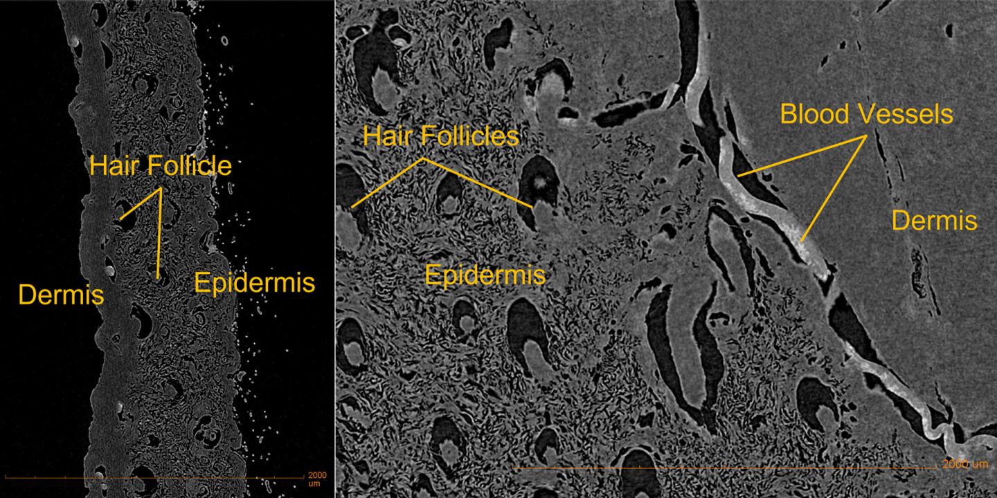 Revolutionize your imaging of soft tissue structure