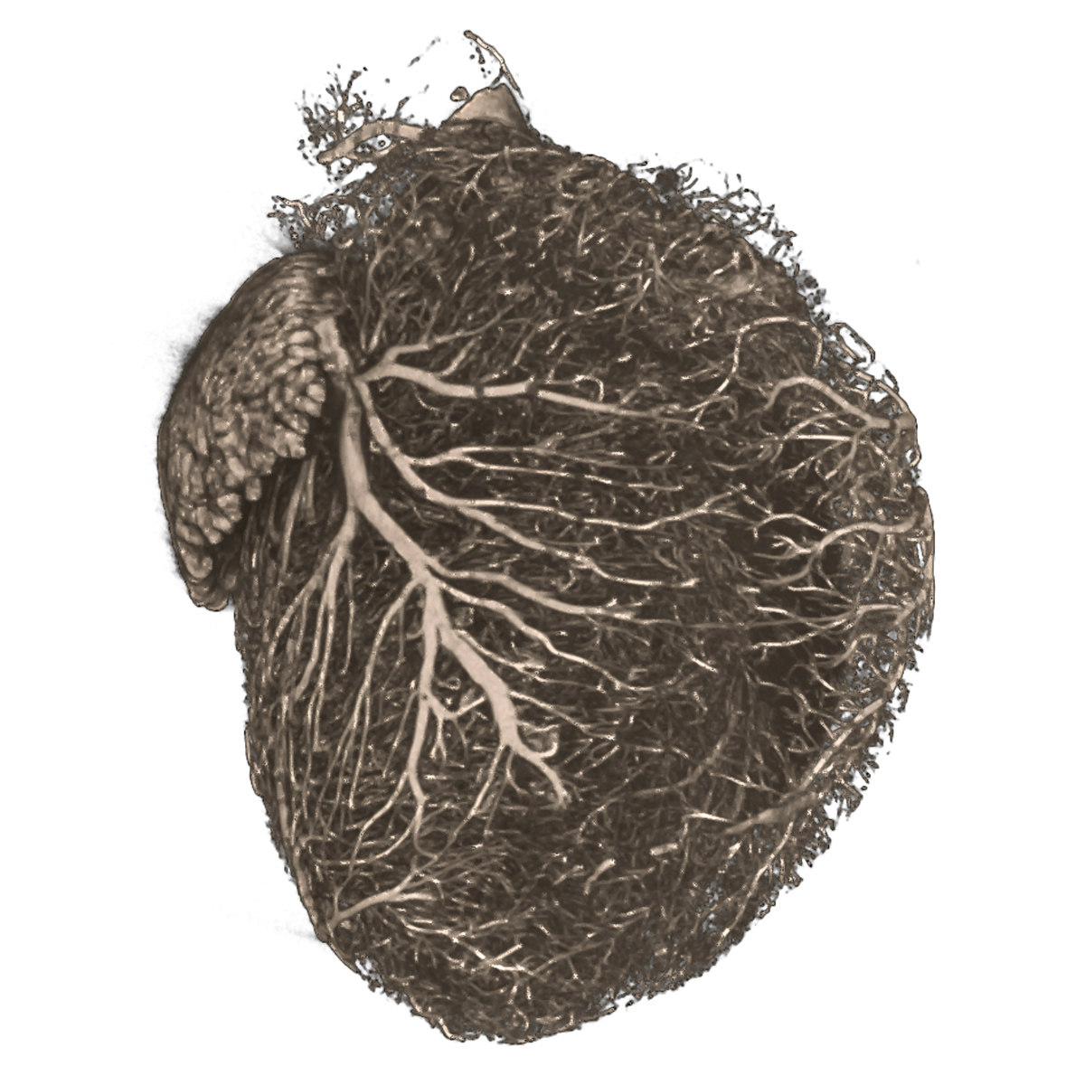 Revolutionize your imaging of soft tissue structure